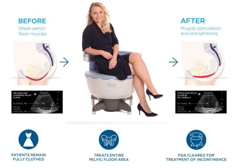 Guide to Pelvic Floor Tightening Using an EmSella® Chair